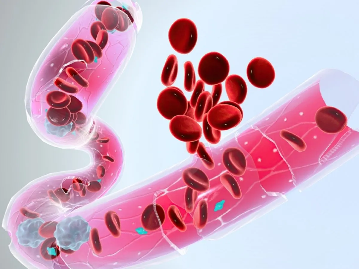 La FDA aprueba Altuviiio una vez por semana, una nueva clase de terapia ...