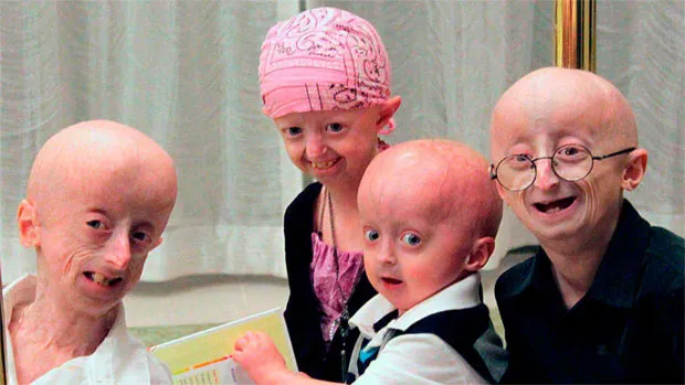 Ensaios De Tratamento De Progeria Dr. Diogo Soares | Médico