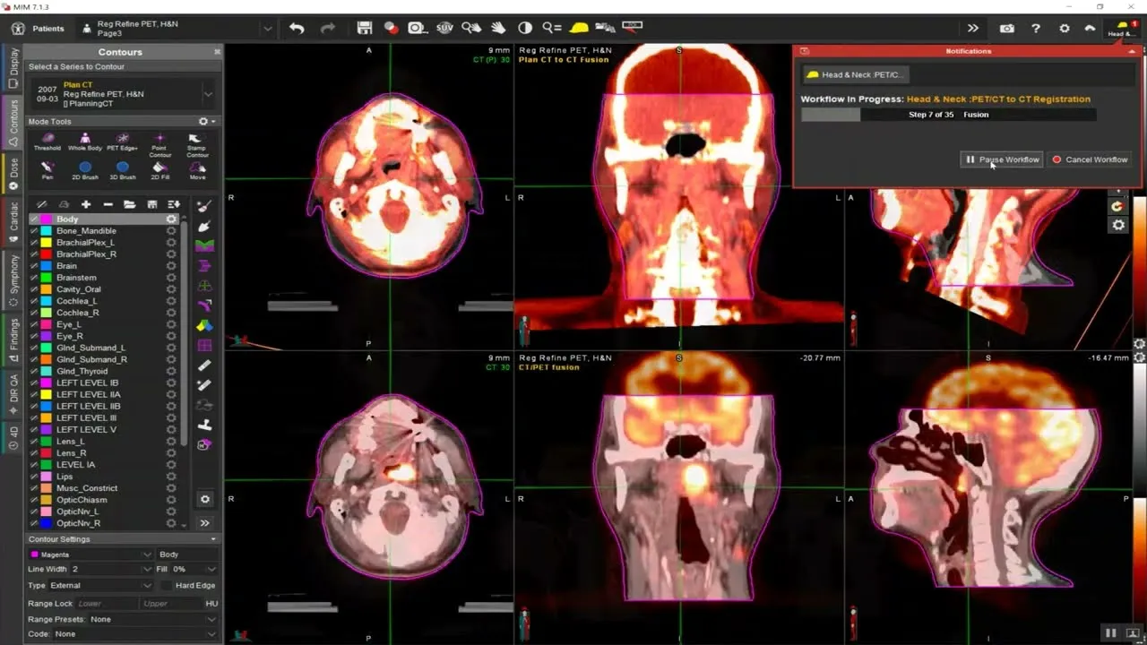GE HealthCare adquiere MIM Software